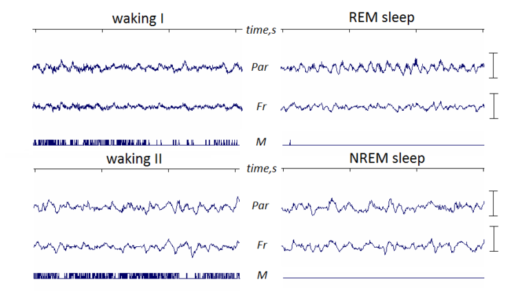 Normal_EEG_of_mouse - La Fondation Droit Animal, Ethique et Sciences